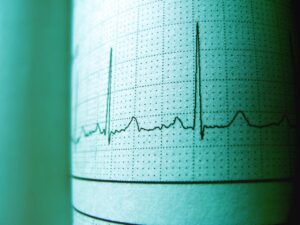 Battito Cardiaco Irregolare: Quando Preoccuparsi e Come Proteggere la ...